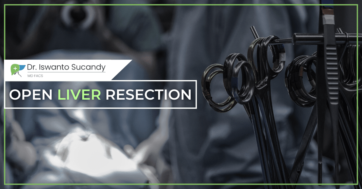 Open Liver Resection | Open Liver Surgery | Visit Our Tampa Liver Center